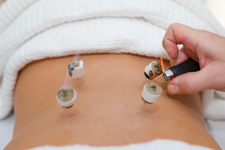 Services - Gippsland Acupuncture